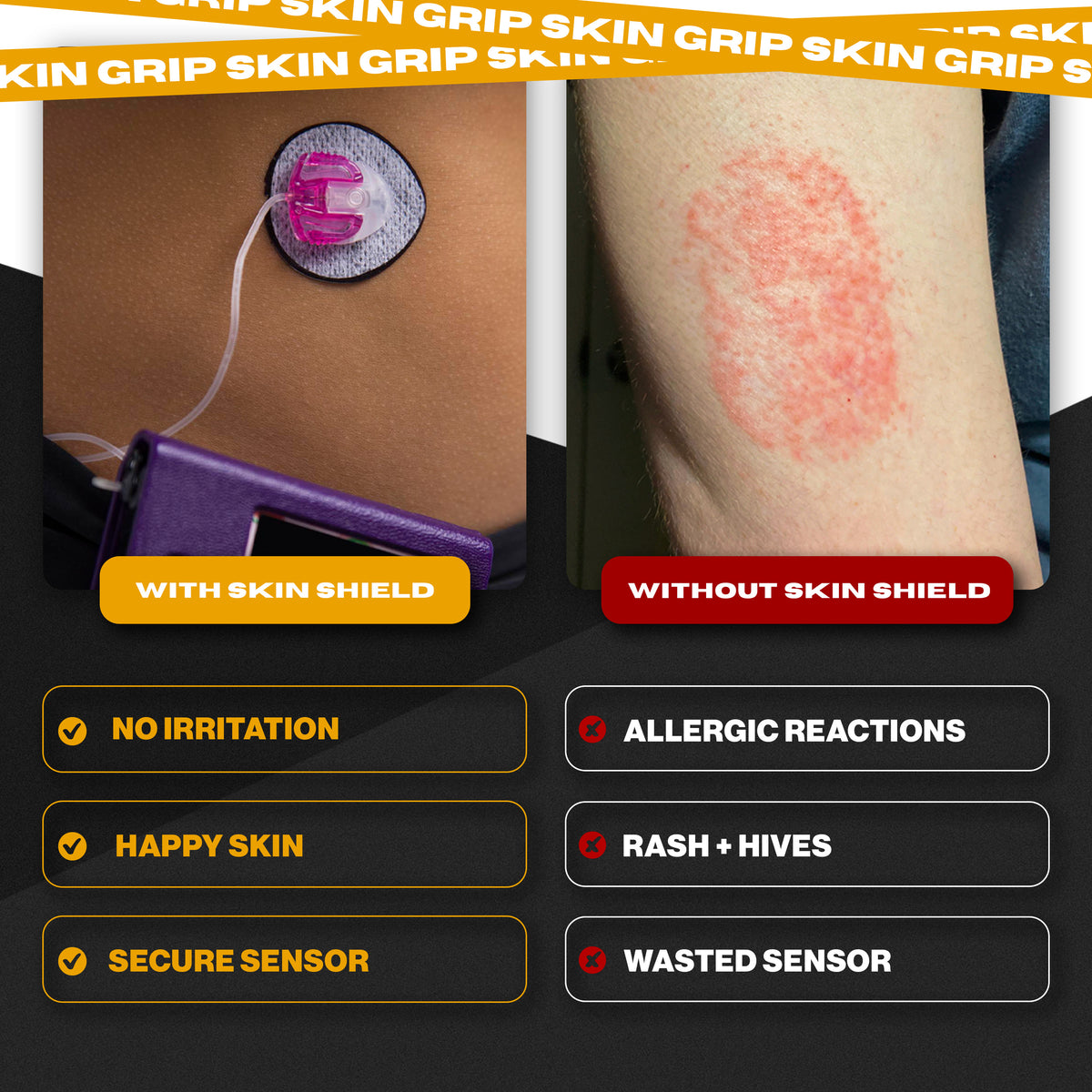 Skin Defender By Skin Grip - Infusion Sets - Diabeticsupply.co.uk