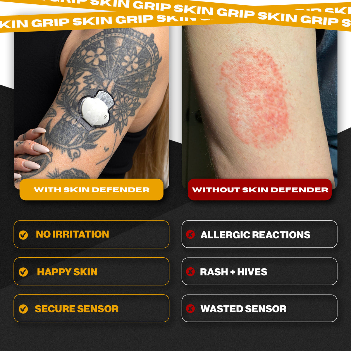 Skin Defender by Skin Grip - Medtronic - Diabeticsupply.co.uk